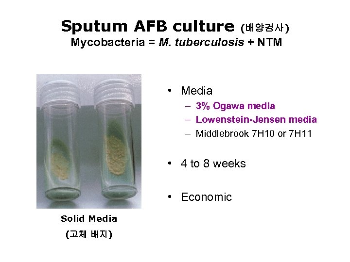 Diagnostic methods of pulmonary tuberculosis Yee Hyung Kim