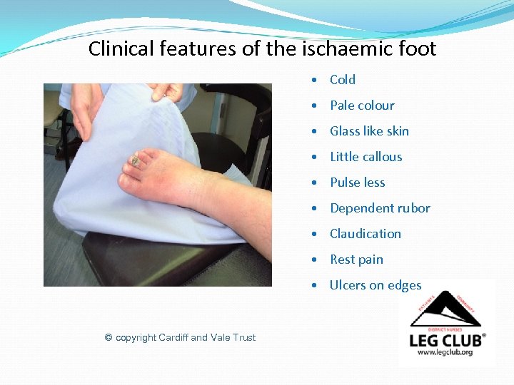 Leg Assessment and IPC Elaine Gibson BSc Hons Dip