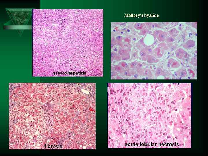 БОЛЕЗНИ ПЕЧЕНИ Функции печени Ú Образование желчи