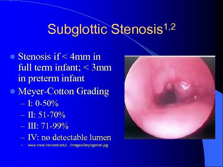 Differential Diagnosis Infantile Stridor Amy Stinson MS IV