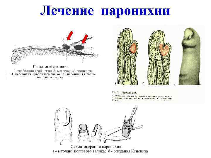Клинический пример 1 На прием к хирургу обратился