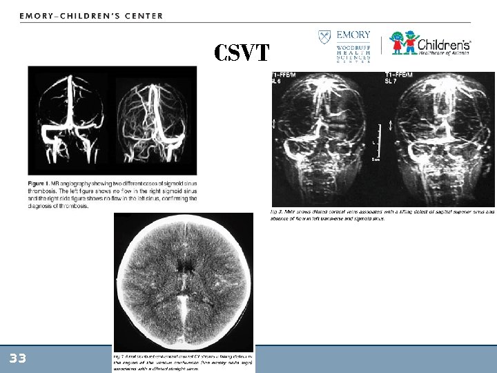 CEREBRAL VASCULAR ACCIDENTS Pediatric Critical Care Medicine Emory