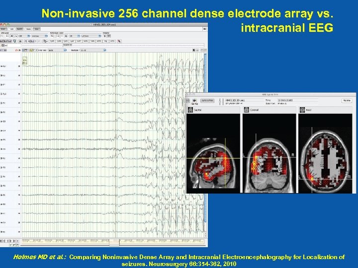 EEG and Event Related Potentials in Psychiatry October
