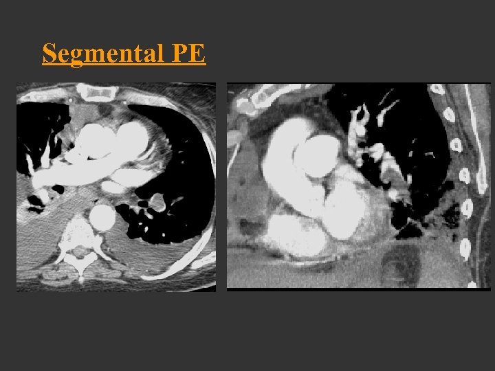 Longwood Non-invasive Cardiac Imaging Seminar December 14 2009