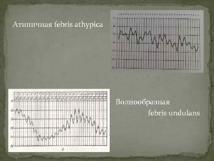 Дифференциальная диагностика заболеваний протекающих с лихорадкой Лихорадка