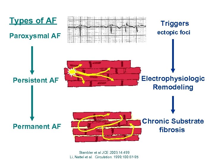 Management of Atrial Fibrillation in Heart Failure Maximo