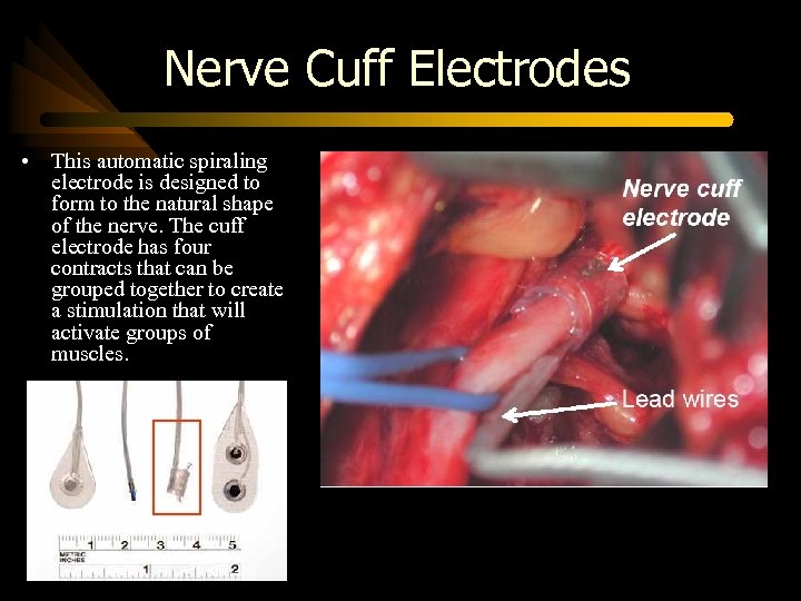 An Introduction to Functional Electrical Stimulation Presented by