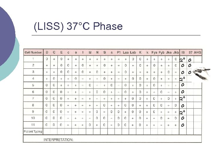 Antibody Identification Renee Wilkins Ph D MLS ASCP cm CLS
