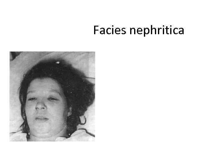 Кафедра пропедевтики внутренних болезней ОБСЛЕДОВАНИЕ БОЛЬНОГО В КЛИНИКЕ