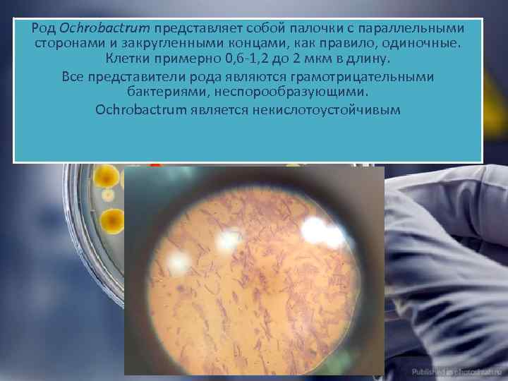 Цитологические особенности штамма Ochrobactrum sp Работу выполнил студент