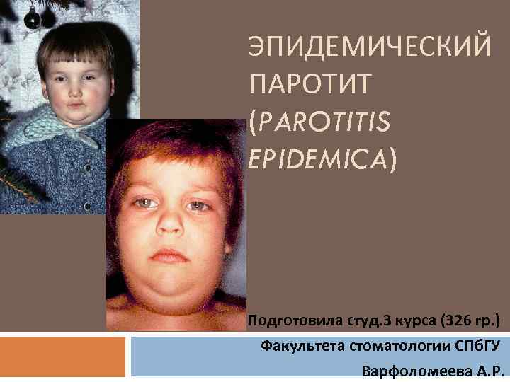 ЭПИДЕМИЧЕСКИЙ ПАРОТИТ PAROTITIS EPIDEMICA Подготовила студ 3 курса