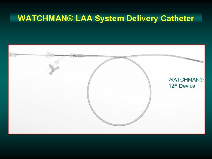 Left Atrial Appendage Closure for Stroke Prevention in