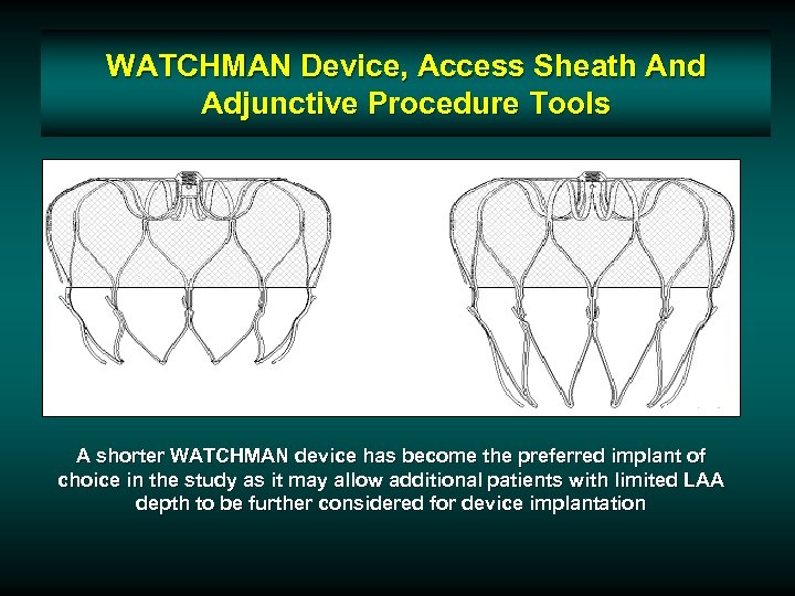 Left Atrial Appendage Closure for Stroke Prevention in