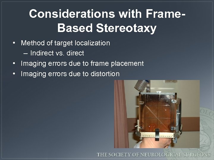 Principles of Neuronavigation Frame and Frameless