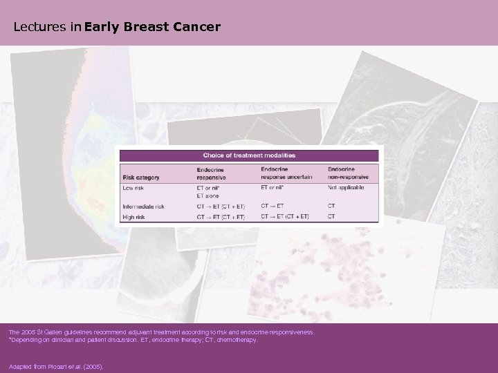 Lectures in Early Breast Cancer A Power Point