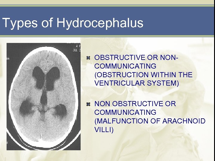Based on the Medical Student Curriculum in Neurosurgery