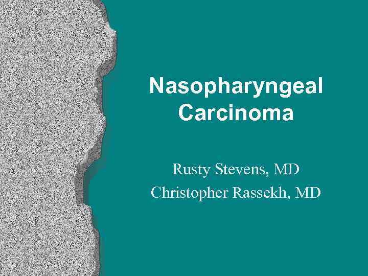 Nasopharyngeal Carcinoma Rusty Stevens MD Christopher Rassekh MD