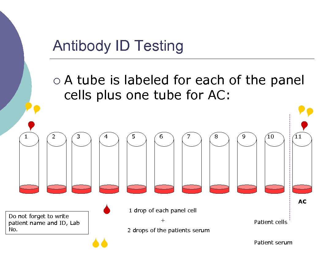 Antibody Identification Mohammed Jaber Antibody Presence of