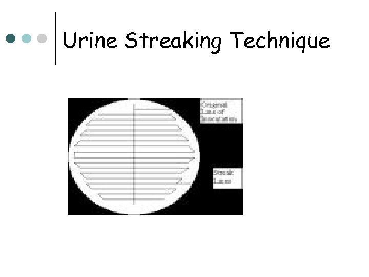 Urinary Tract Infections MLAB 2534 Microbiology Keri Brophy-Martinez