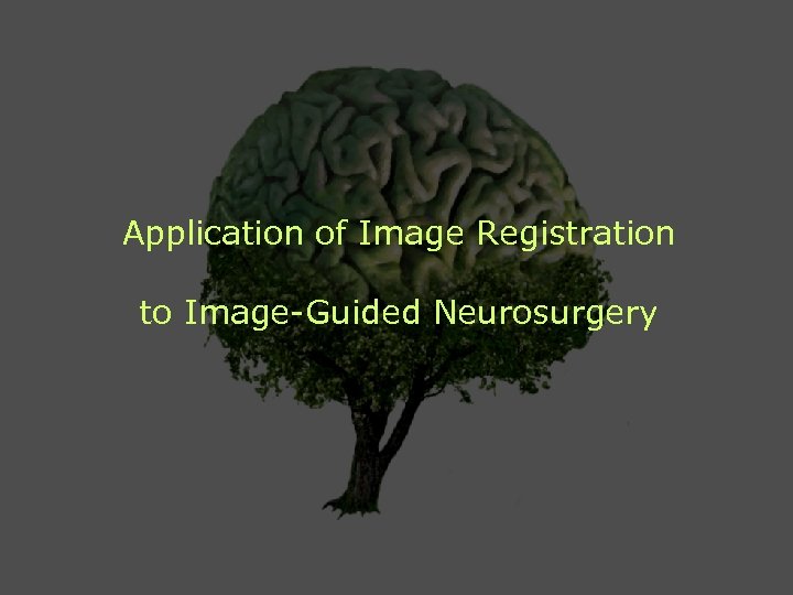Image Registration and Application to Image-Guided Neurosurgery Lara