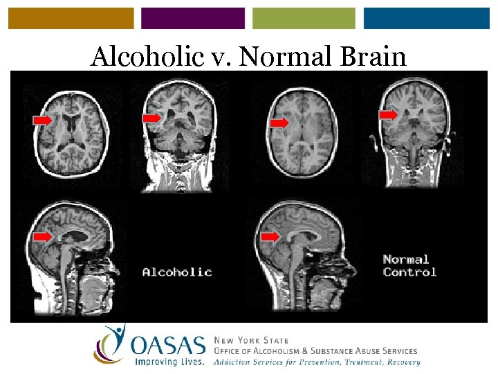 Understanding Alcohol Abuse and Addiction Steve Hanson Associate