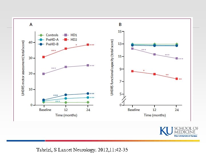 When does Huntington s Disease Begin Richard Dubinsky MD