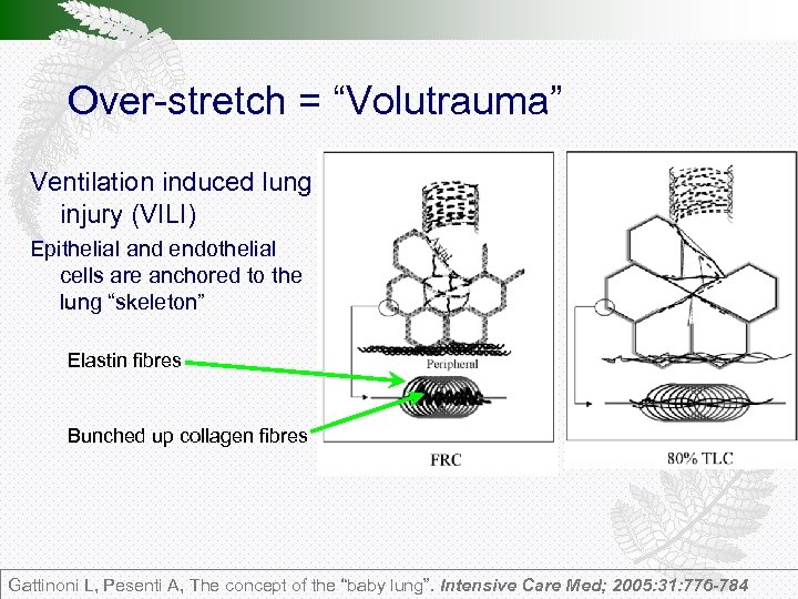 Man and machines Insights into ventilation strategies May