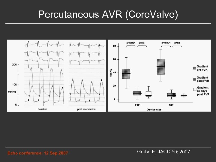 Aortic Stenosis Randall Harada Echo conference 12 Sep
