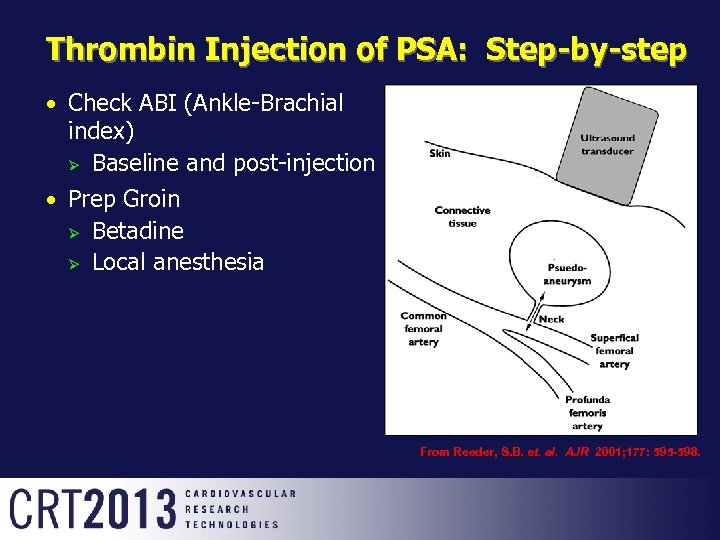 Safety and Efficacy of Ultrasound-Guided Thrombin Injections at