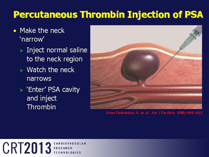 Safety and Efficacy of Ultrasound-Guided Thrombin Injections at