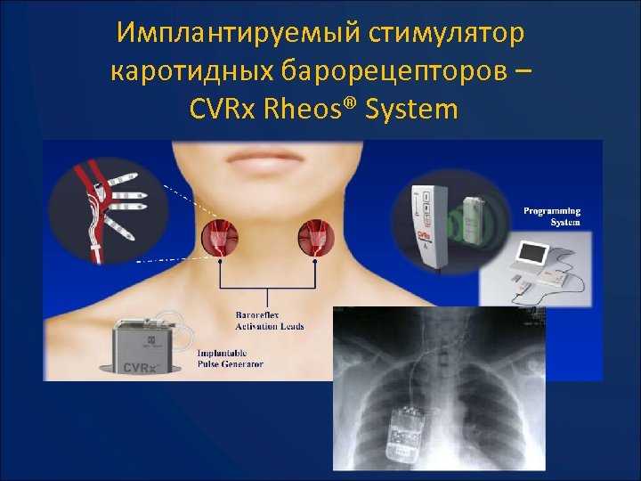 ФГБУ РКНПК Институт Клинической Кардиологии им А Л