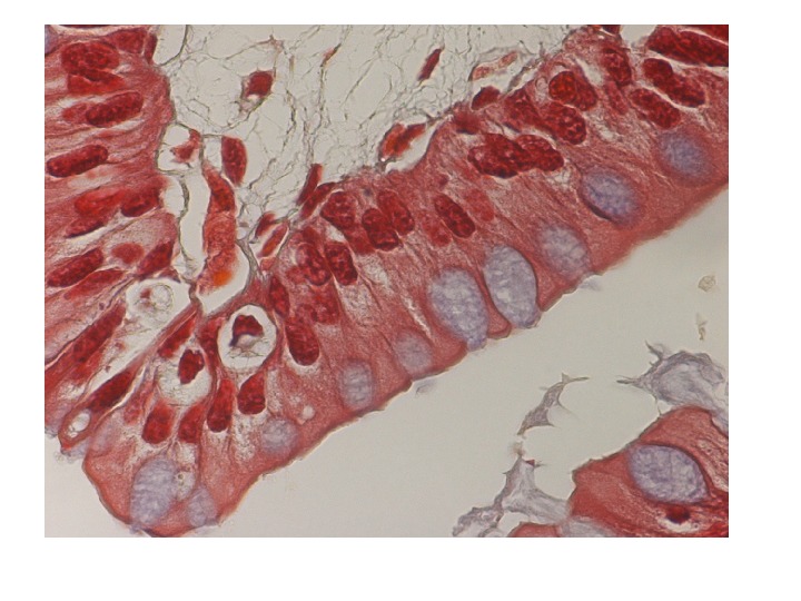 Т КАНИ. МОРФОФУНКЦИОНАЛЬНАЯ ХАРАКТЕРИСТИКА ЭПИТЕЛИАЛЬНЫХ ТКАНЕЙ.